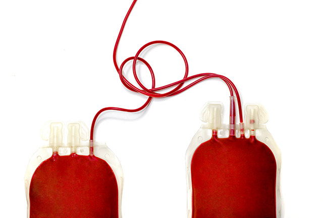 Exchange Transfusion | JNU Hospital